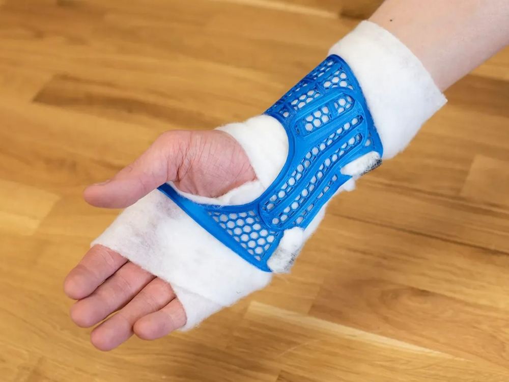 Penang,Bayan Lepas 3D Printed Medical Accessories - Splints / Wrist ...